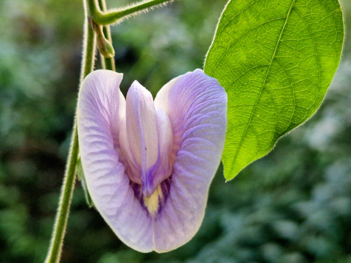 Intimplasztika: ezért vállalják sokan a műtétet - Nők Lapja