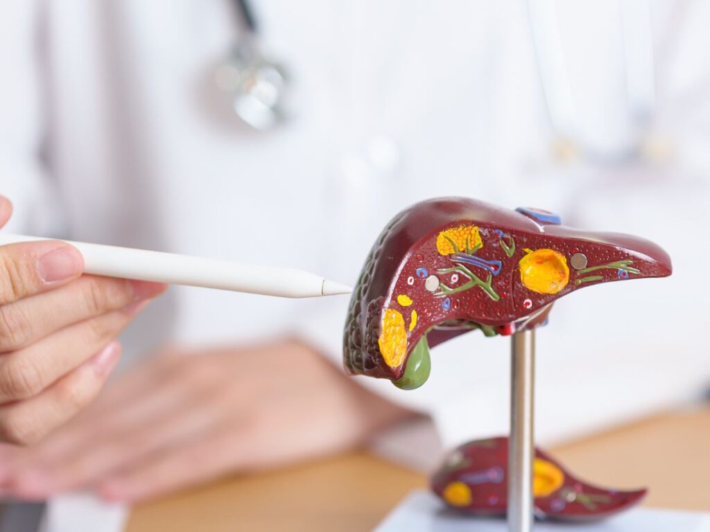 Az epehólyag gyulladása: 5 tipikus tünet - Nők Lapja