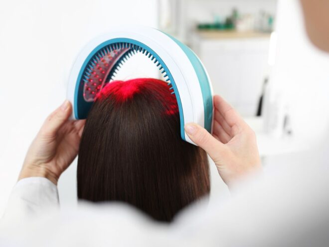 Hullik a hajad? Így állíthatod meg a folyamatot! - Nők Lapja